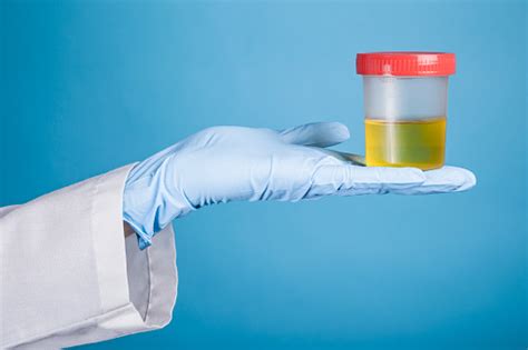 파란색 장갑에 손을 잡고 의료 소변 검사를 들고 파란색 배경에 소변에 대한 스톡 사진 및 기타 이미지 소변 용기 제작물