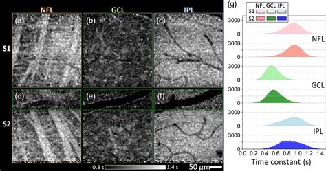 Suite Of Methods For Assessing Inner Retinal Temporal Dynamics Across Spatial And Temporal