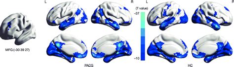 Brain Regions Showed Significant Alteration P Download Scientific