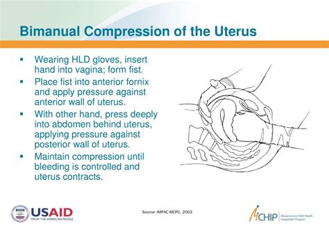 Ppt Postpartum Hemorrhage Pph Prevention And Management Powerpoint