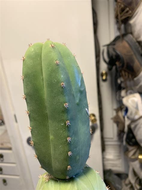 Been Getting These Strange Bumps Not Squishy Or Sticky Or Discolored Just Ripple And Bumpy