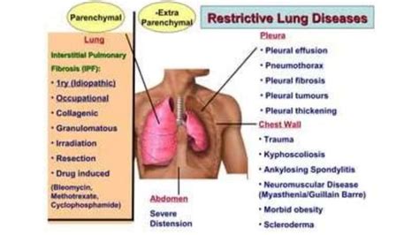Obstructive Vs Restrictive Pulmonary Disease Pathology Atot Pptx Lung And Respiratory