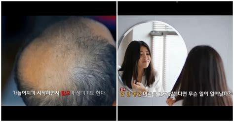 한달동안 머리를 감지 않으면 생기는 일