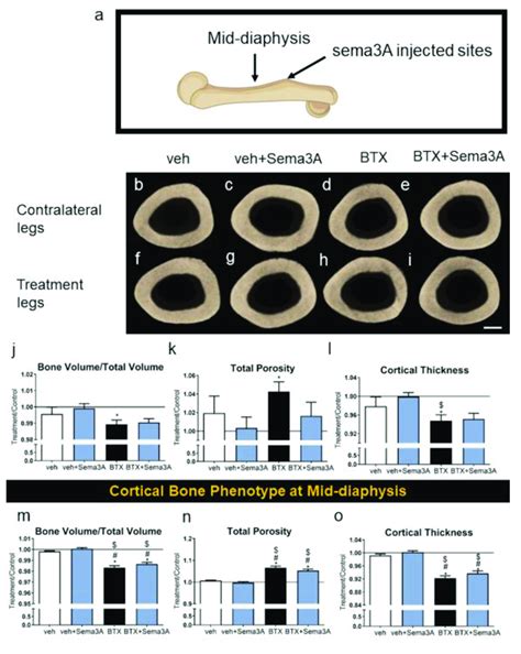 Effect Of Sema3a On Cortical Bone Formation At The Sema3a Injected