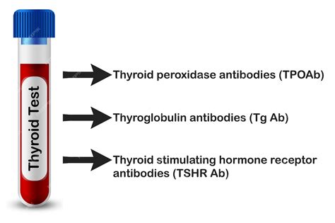 Premium Photo Thyroid Profile Test Concept With Test