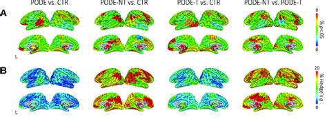 Heatmaps Of Functional Connectivity Alterations A Qualitatively