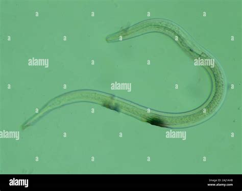 Nematoda Hookworm