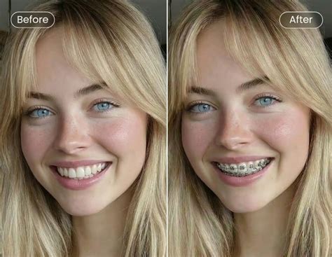 Braces Filter Online Virtual Braces Try On Free Fotor