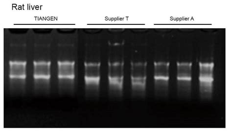 Rna Easy Fast Tissue Cell Kit Rna Product Tiangen