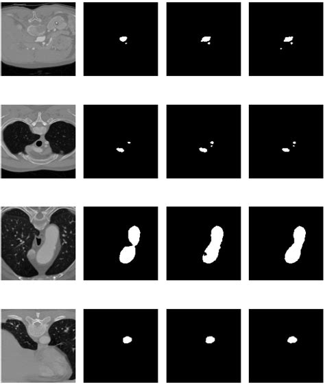 Random Examples Of Predictions Columns From Left To Right Show The Download Scientific