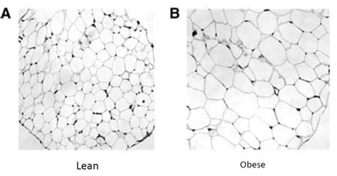 vtpp 427 body composition flashcards quizlet