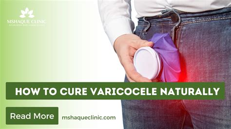 Varicocele Natural Treatment