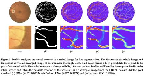 Iternet Retinal Image Segmentation Utilizing Structural Redundancy In