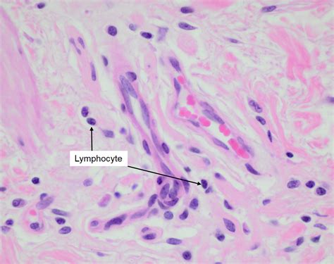 Fibroblast Histology