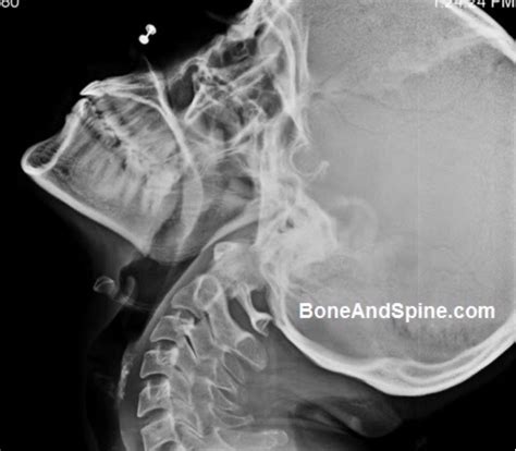 Flynavy Navalaviation Pilot Helicopterpilot Aviationindustry Aviation Flightsafety