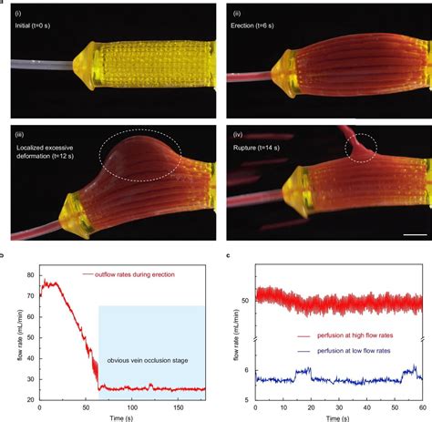 Can 3d Printed Implants Restore Erectile Function New Research Shows