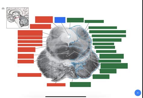Caudal Midbrain Structures Diagram Quizlet