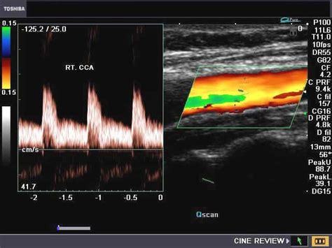 Ultrasound Waves And Propagation Do It Easy With Scienceprog