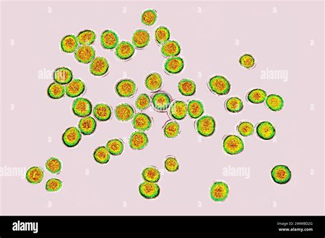 Staphylococci Staphylococcus Pyogenes Aureus Bacteria Responsible Staphylococci Staphylococcus Pyogenes Aureus Bacteria Responsible