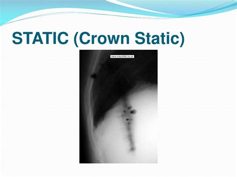 Ppt Artifact Analysis Powerpoint Presentation Free Download Id2043091