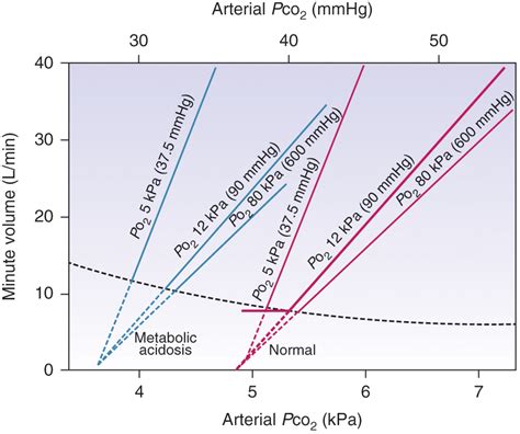 Co2 Response Curve Anesthesia