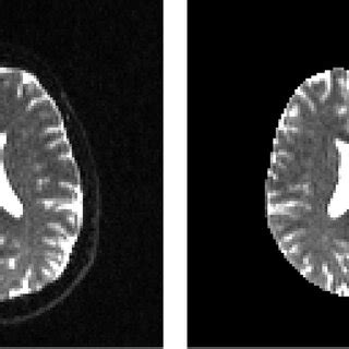 Diffusion Tensor Based Scalar Maps Created With Dipy Download Scientific Diagram