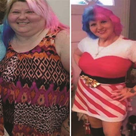 Bariatric Surgery In Cape Girardeau Mo Southern Missouri 2024