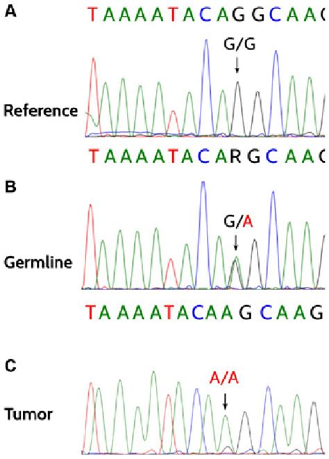 Heterozygous Germline Mutation In Brca2 Exon 17 C 7976g A Download Scientific Diagram