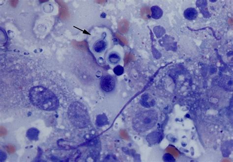 Infectious Agents Cytology Eclinpath