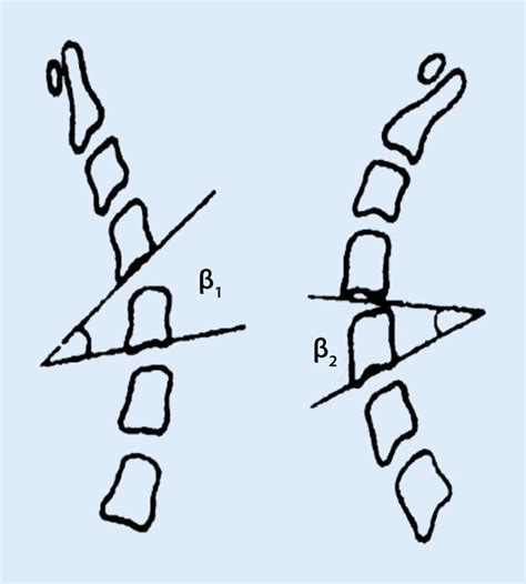 Diagram Showing Measurement Of The Angular Displacement Of The Download Scientific Diagram