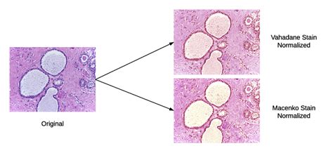 The Two Types Of Stain Normalization On An Image Download Scientific