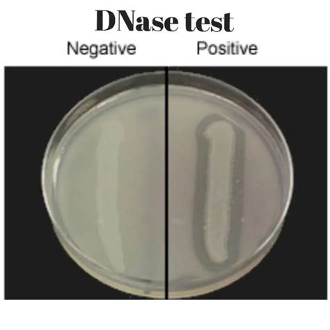 Dnase Test Principle Procedure Result Uses Biology Notes Online
