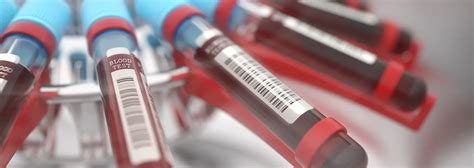 Exámenes De Sangre En Salud Digna Costos Y Ubicaciones
