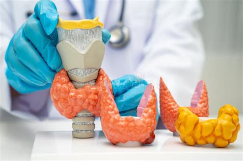 Hyperthyroidism Overactive Thyroid Thyroid Lymphoma Asian Doctor With Thyroid Gland Human