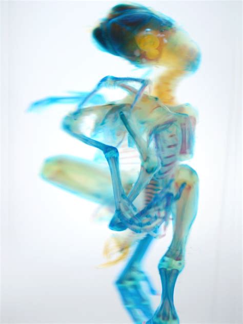 Nighttime Nicholas Toronto Diaphonizion And Cleared And Stained Specimens