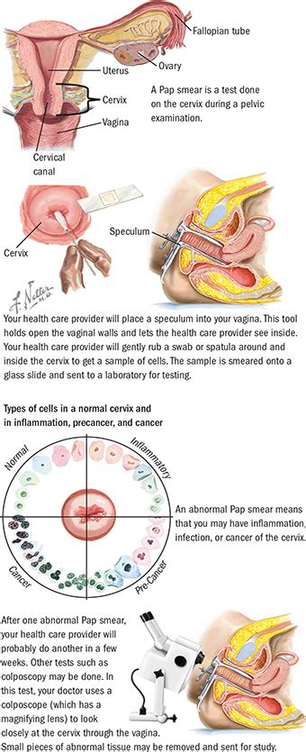 Abnormal Pap Smear Colposcopy