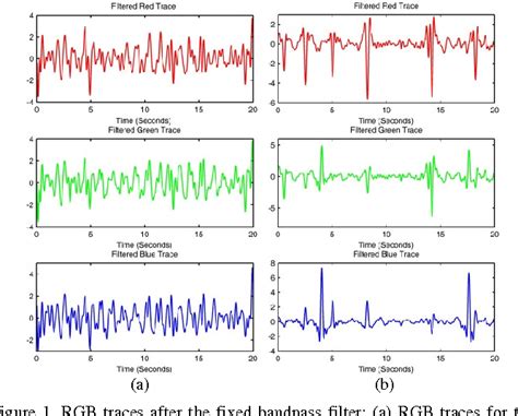 figure 2 from motion artifacts suppression for remote imaging photoplethysmography semantic