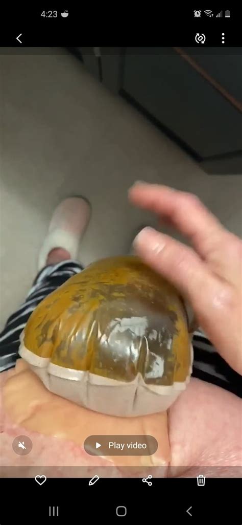 Thanks I Hate It My Moms Colostomy Bag Filled With Air Gas Over