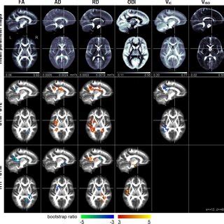 Top Row Mean Voxelwise DTI And NODDI Diffusion Parameter Maps Download Scientific Diagram