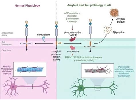Brain Matrix Alliance On Linkedin Earlydetection Bloodtest Alzheimersresearch Prevention