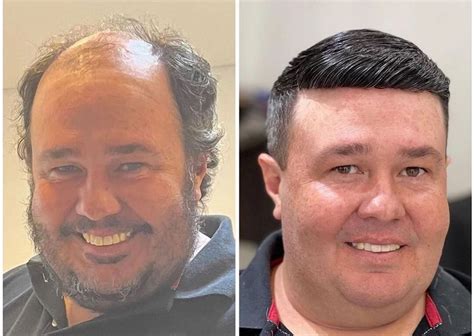 Фризер им дава нов изглед на мажи кои страдаат од опаѓање на косата и резултатите се неверојатни