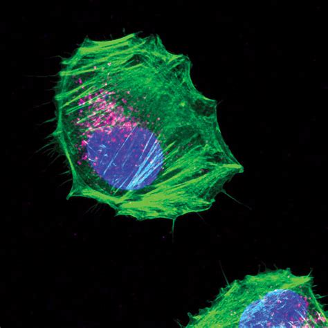 Visions Of A Continuous Bioprocess Future