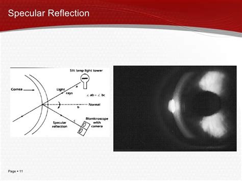 Slit Lamp Illumination Techniques