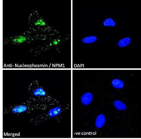 Anti Npm1 Nucleophosmin 抗体 Arg63739 Arigobio