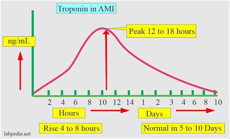 Cardiac Marker Troponins Troponin T And Troponin I