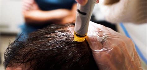 Diagnosis Treatment For Scalp Infections