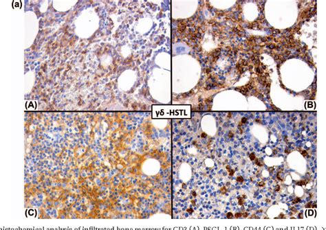 High Speed Transceiver Logic Semantic Scholar