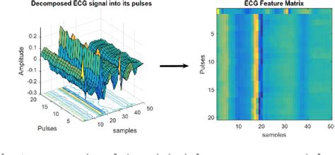 Figure 3 From Development Of An Efficient Ecg And Ppg Signal Processing