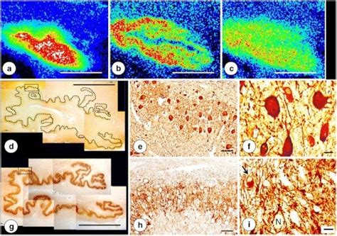 Fe Cu And Zn Xrf Maps Of A Normal Dn And Matching Sections After