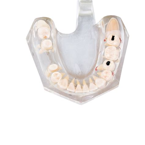 Macromodelo Con Patología Completa
